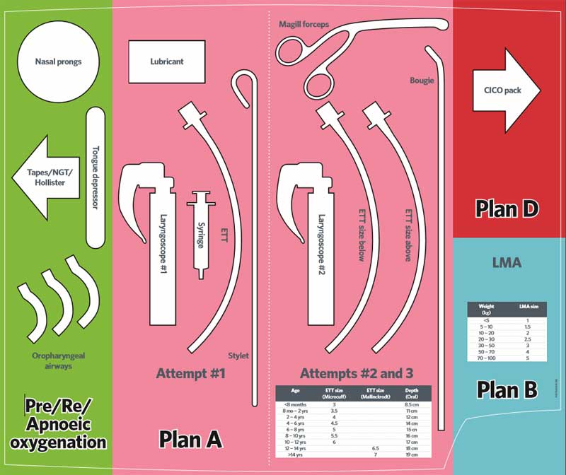 Airway Plan Kit Dump KI Doc